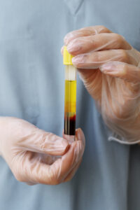 PRP Therapy for Foot & Ankle: Key Benefits Explained